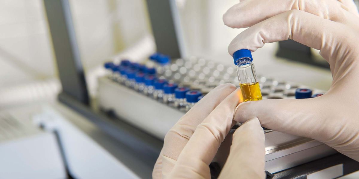 Laboratory Proficiency Testing Market Driven By Growth Owing To Rising ...