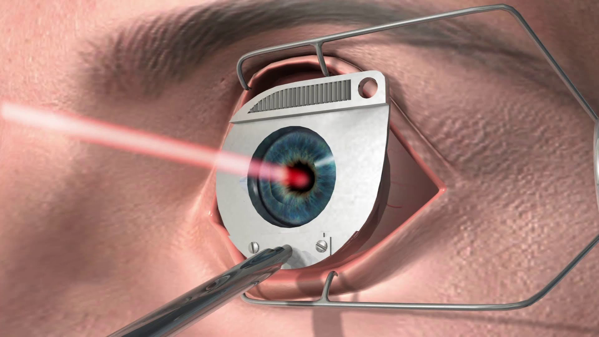 Non-Invasive Biosensors Market Trends, Size, and Share Analysis
