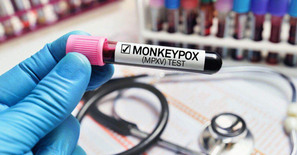 Monkeypox Treatment: Understanding the Options Available