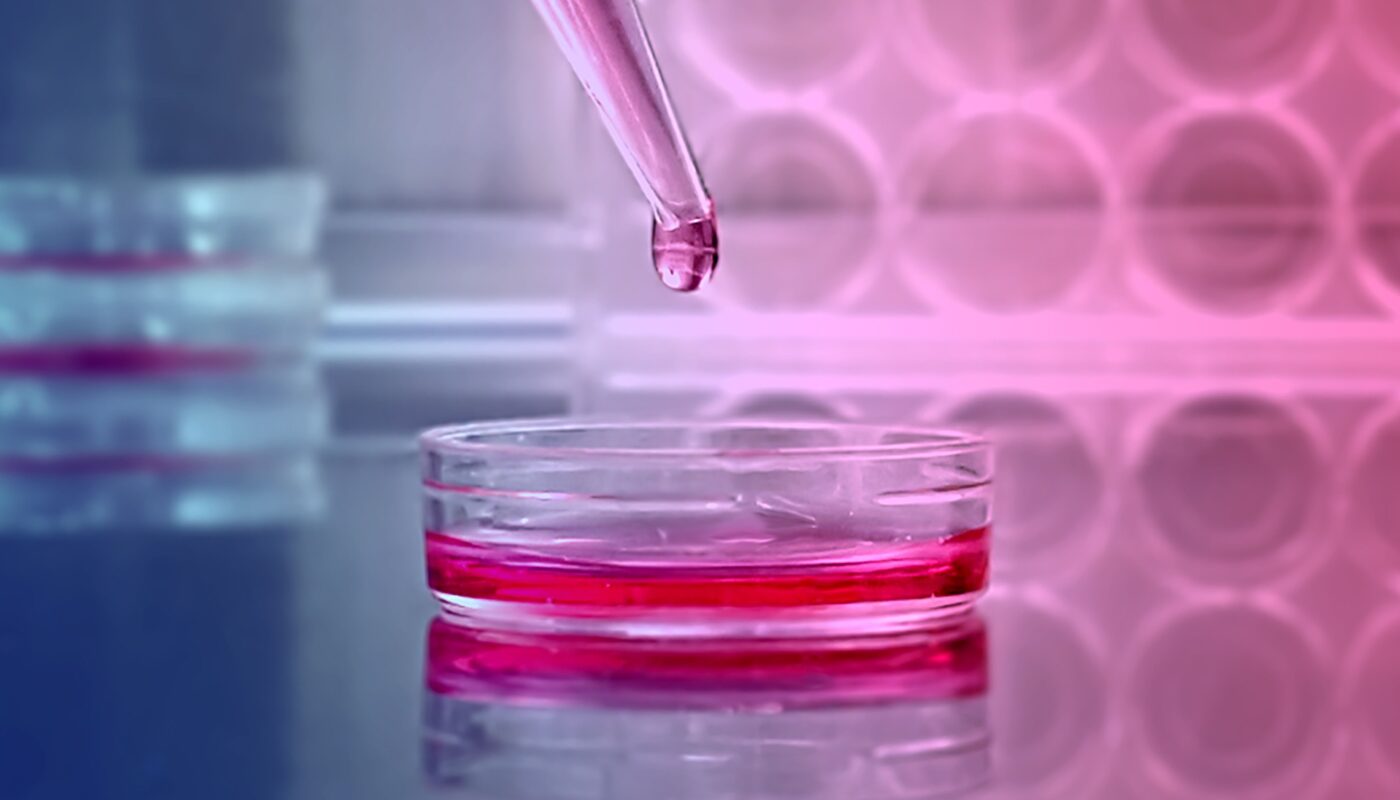 Primary Cell Culture Market is Strengthening by Growing Focus